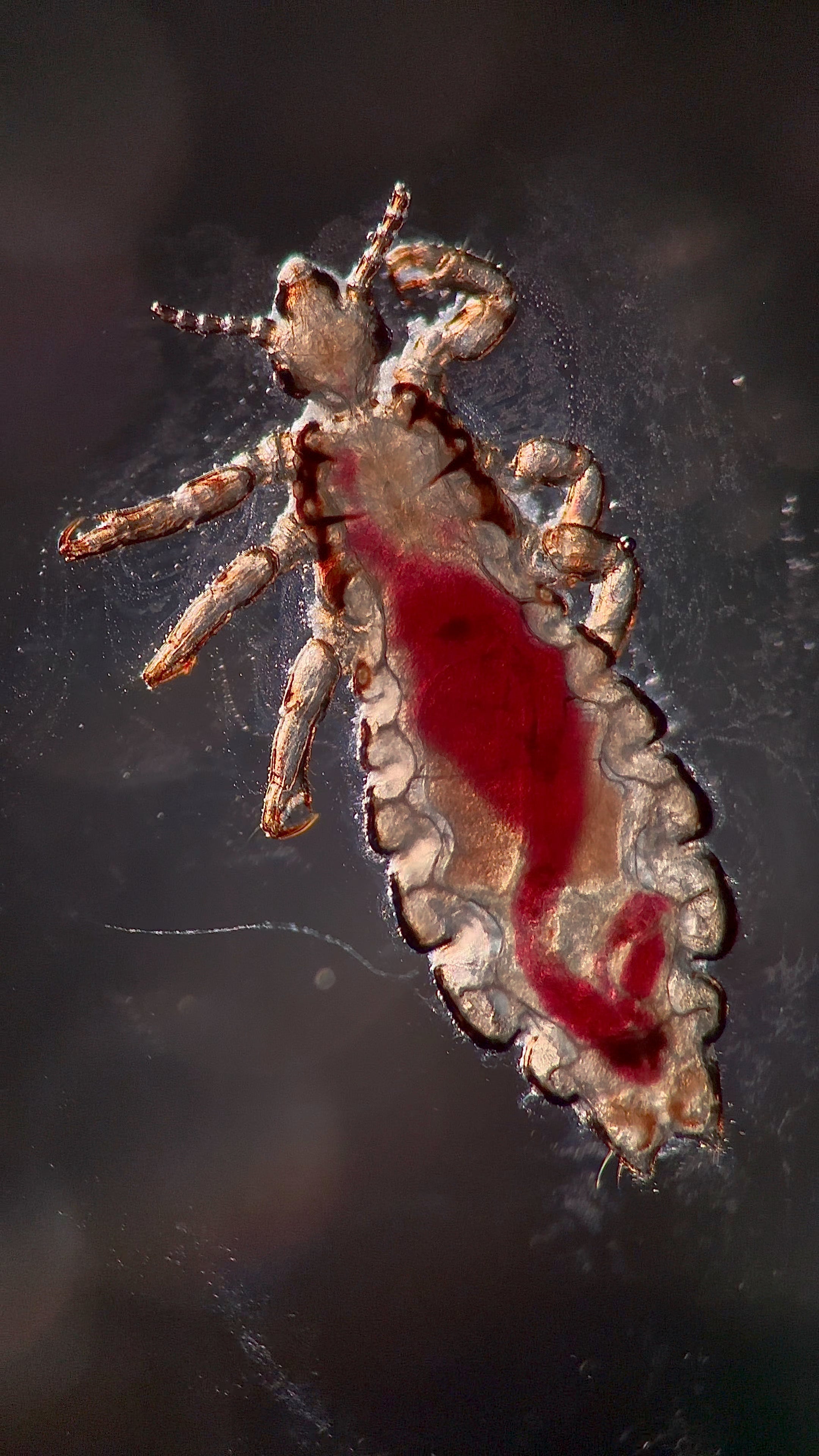 The Itch Nobody Wants: A Closer Look at Head Lice | Microscope Marketplace