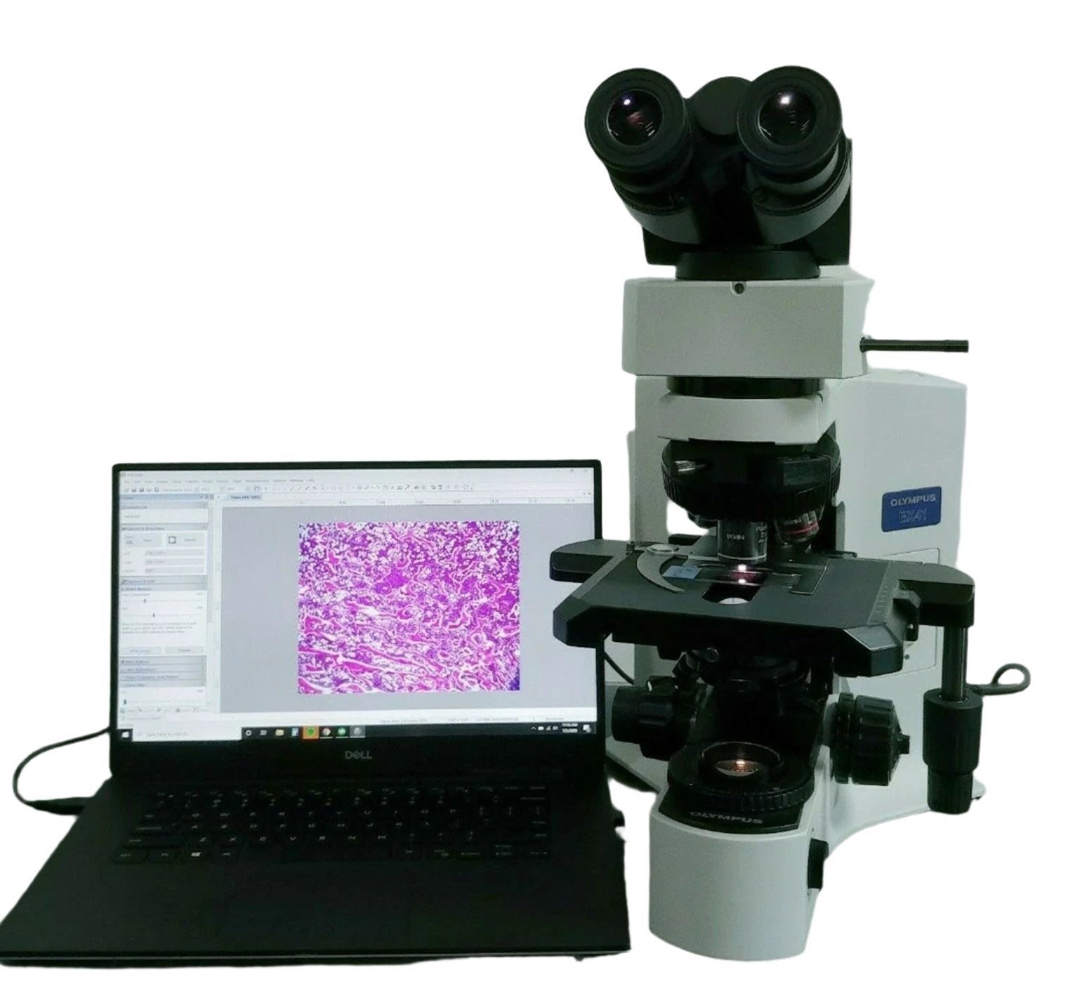 Olympus Microscope BX41 with 2x Apo and Fluorite Objectives and 10 MP ...
